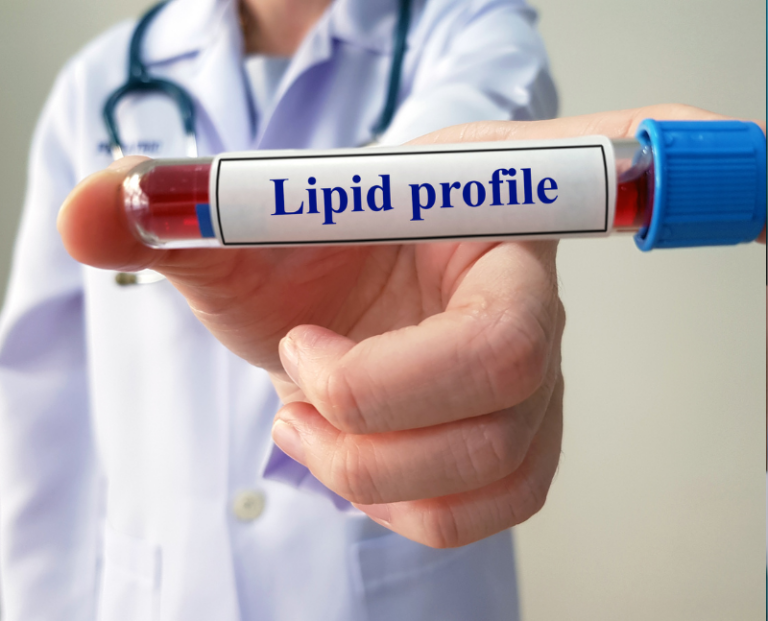 Comprehensive Cholesterol Test | Knightsbridge Pharmacy